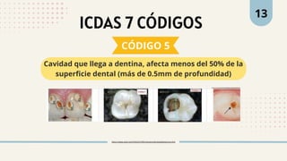 criterios ICDAS, cariologia, avance de las caries .pdf