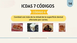 criterios ICDAS, cariologia, avance de las caries .pdf