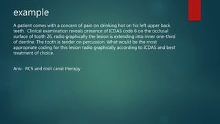 Icdas caries ppt | PPTX