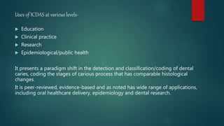 Icdas caries ppt | PPTX