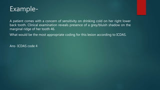 Icdas caries ppt | PPTX