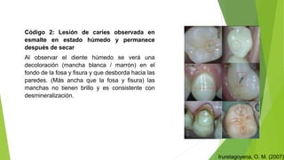 Criterios ICDAS | PPTX