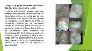 Criterios ICDAS | PPTX