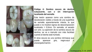 Criterios ICDAS | PPTX