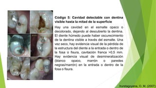 Criterios ICDAS | PPTX