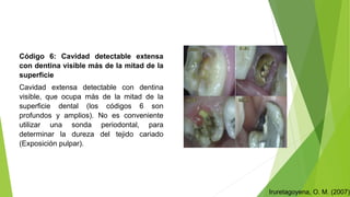 Criterios ICDAS | PPTX