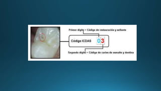 ICDAS | PPTX