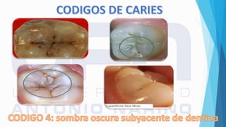 ICDAS | PPTX