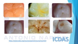 ICDAS | PPTX