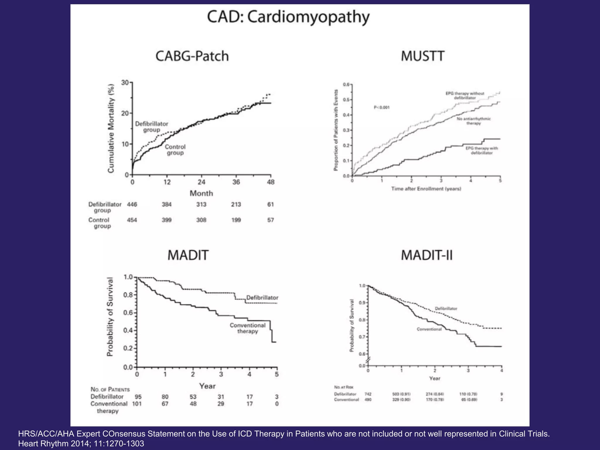 IImplantable Cardioverter Defibrillators (ICDs) - Dr Prithvi puwar | PPTX
