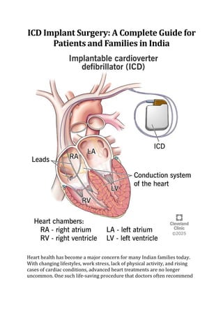 ICD Implant Surgery: A Complete Guide for Patients and Families in ...