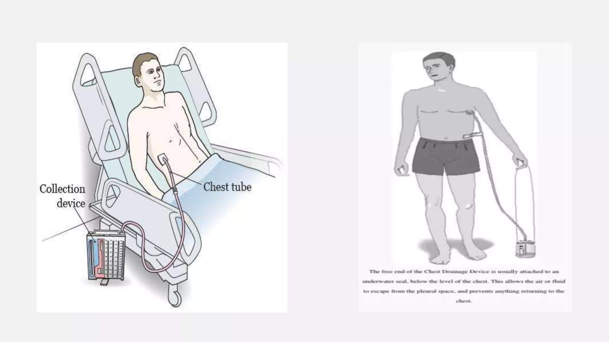 ICD Management..pptx