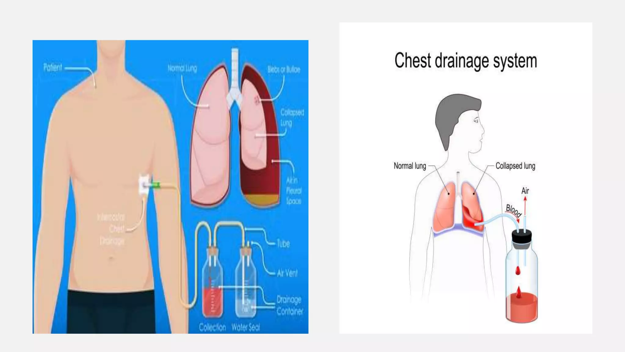 ICD Management..pptx
