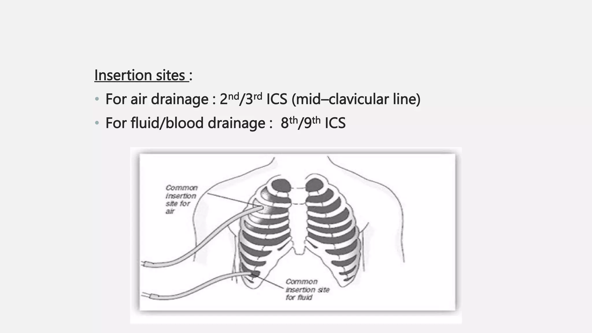 ICD Management..pptx