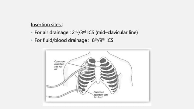ICD Management..pptx
