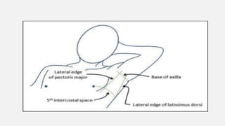 ICD Management..pptx