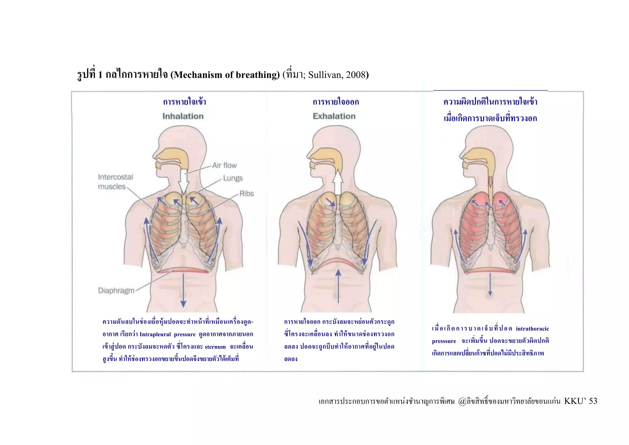 คู่มือ ICD (Chest drain) | PDF