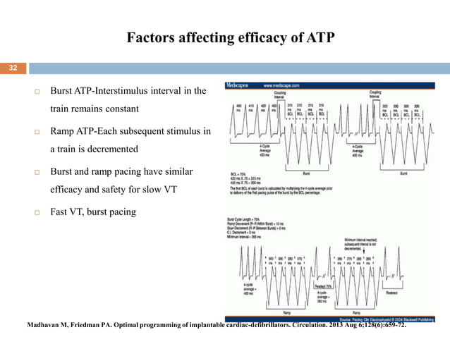 AICD programming | PPTX | Heart and Cardiovascular Diseases | Diseases ...