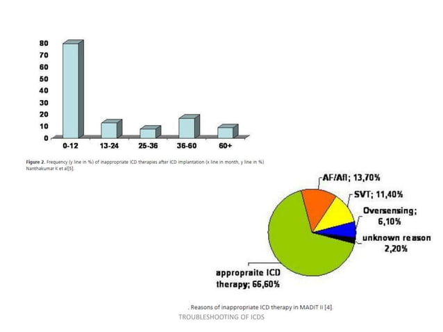 Tachycardia discriminating algorithms and trouble shooting of ICDs | PPTX