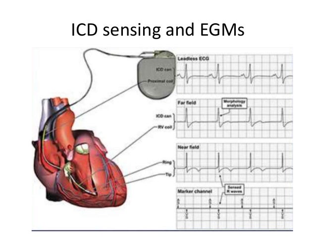 Images of ICD - JapaneseClass.jp