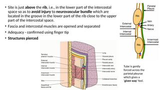 icd + tube thoracostomygydsfgfysadyfasftasdfasytgfs | PPTX