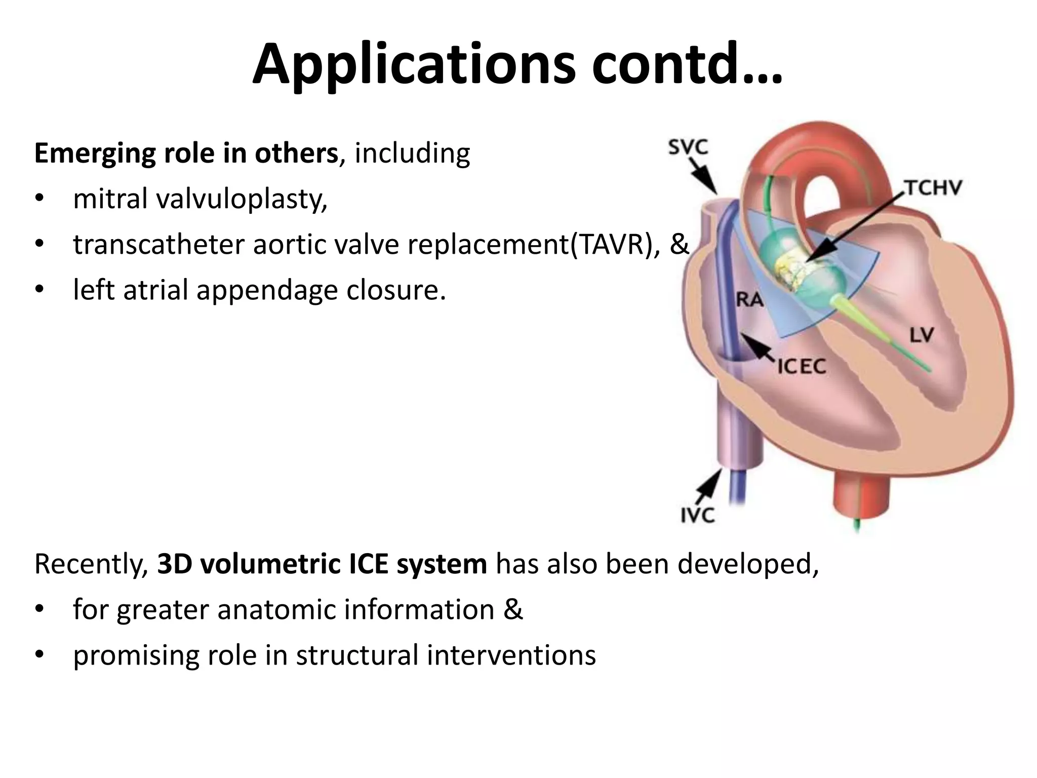 INTRACARDIAC ECHOCARDIOGRAPH (ICE) | PPTX