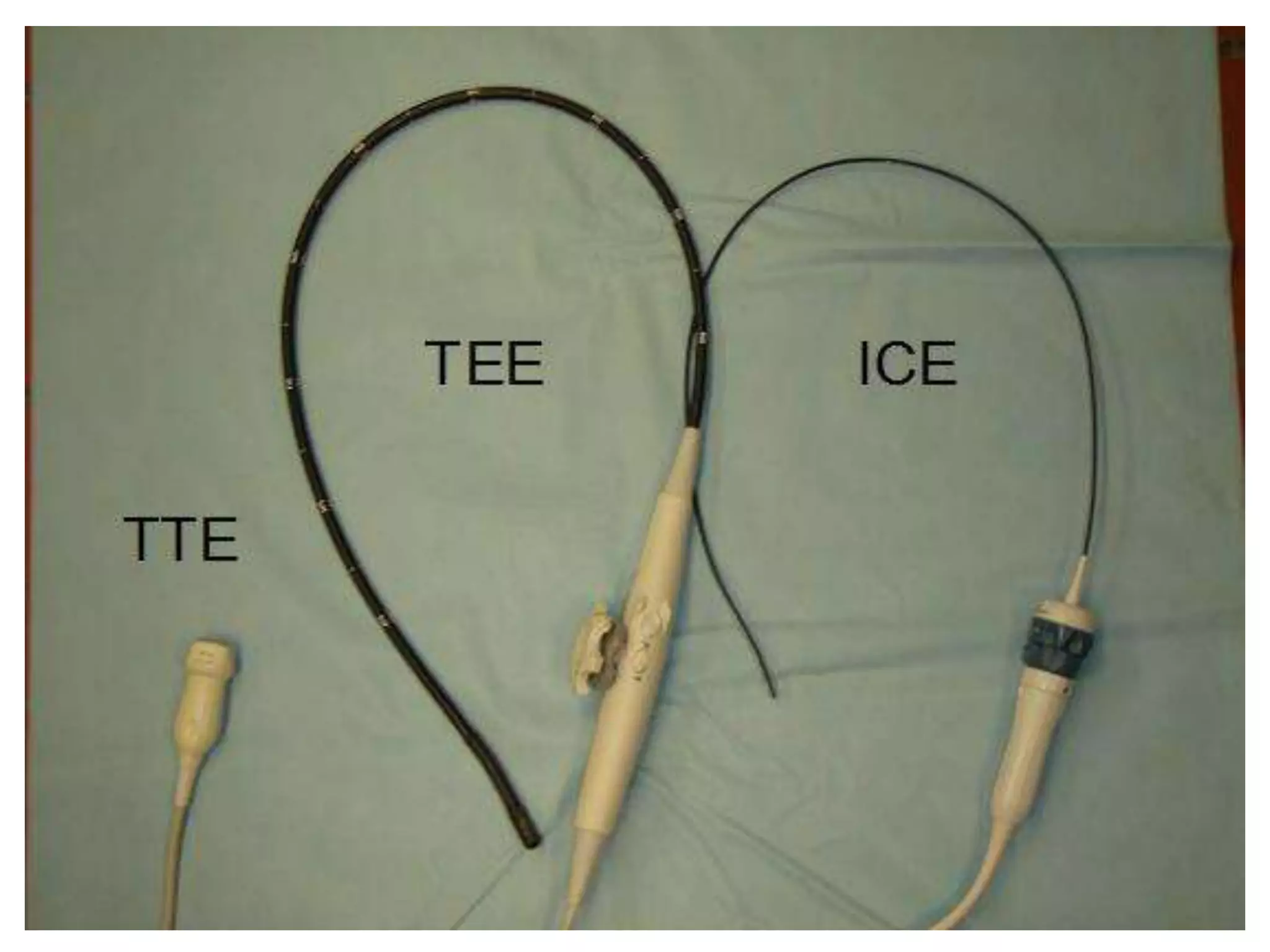 INTRACARDIAC ECHOCARDIOGRAPH (ICE) | PPTX