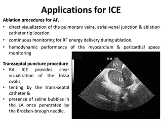 INTRACARDIAC ECHOCARDIOGRAPH (ICE) | PPTX