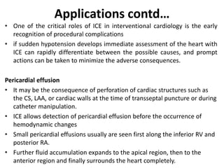 INTRACARDIAC ECHOCARDIOGRAPH (ICE) | PPTX