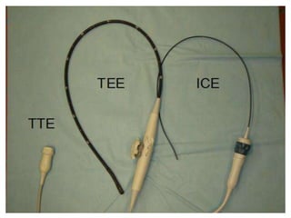 INTRACARDIAC ECHOCARDIOGRAPH (ICE) | PPTX