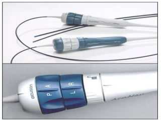 INTRACARDIAC ECHOCARDIOGRAPH (ICE) | PPTX