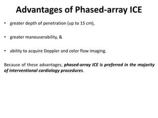 INTRACARDIAC ECHOCARDIOGRAPH (ICE) | PPTX