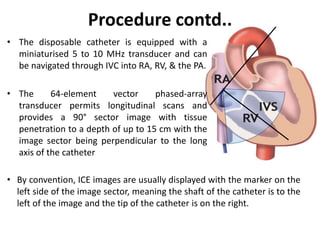 INTRACARDIAC ECHOCARDIOGRAPH (ICE) | PPTX