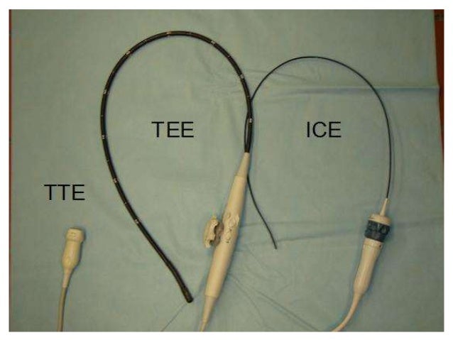 INTRACARDIAC ECHOCARDIOGRAPH (ICE)
