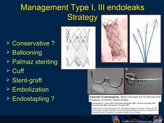 Endoleaks 1, 3 | PPT