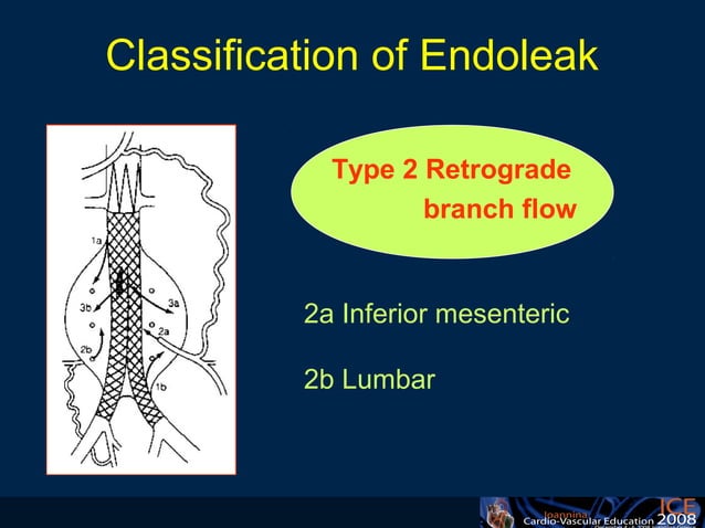 Endoleaks 1, 3 | PPT