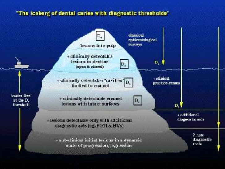 Iceberg phenomena in dentistry