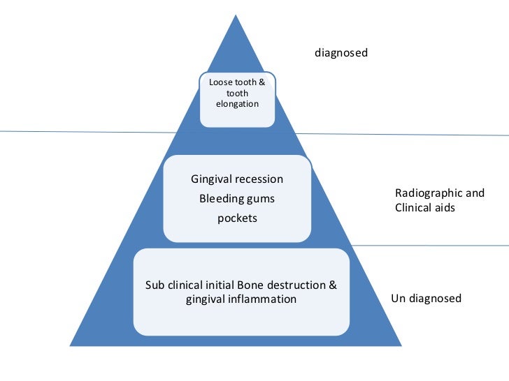 Iceberg phenomena in dentistry