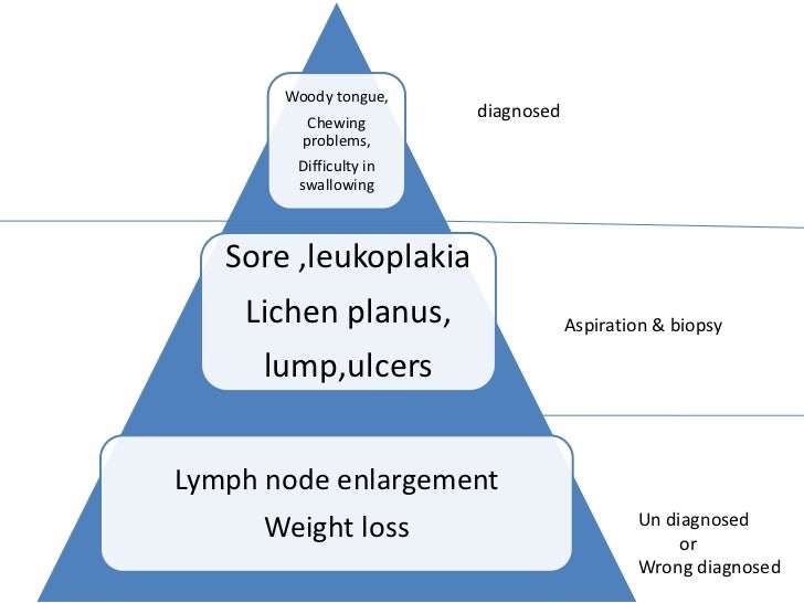 Iceberg phenomena in dentistry