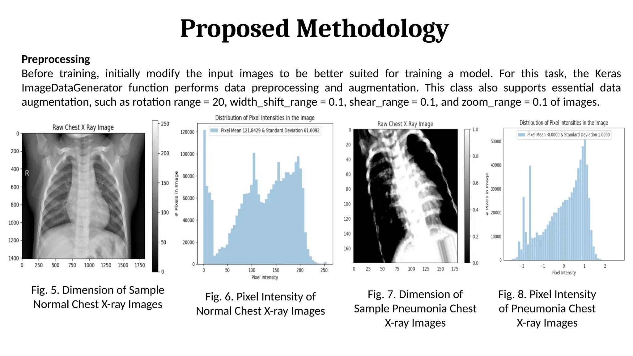 Detection and Classification of Pneumonia with Chest X-Ray Images using ...