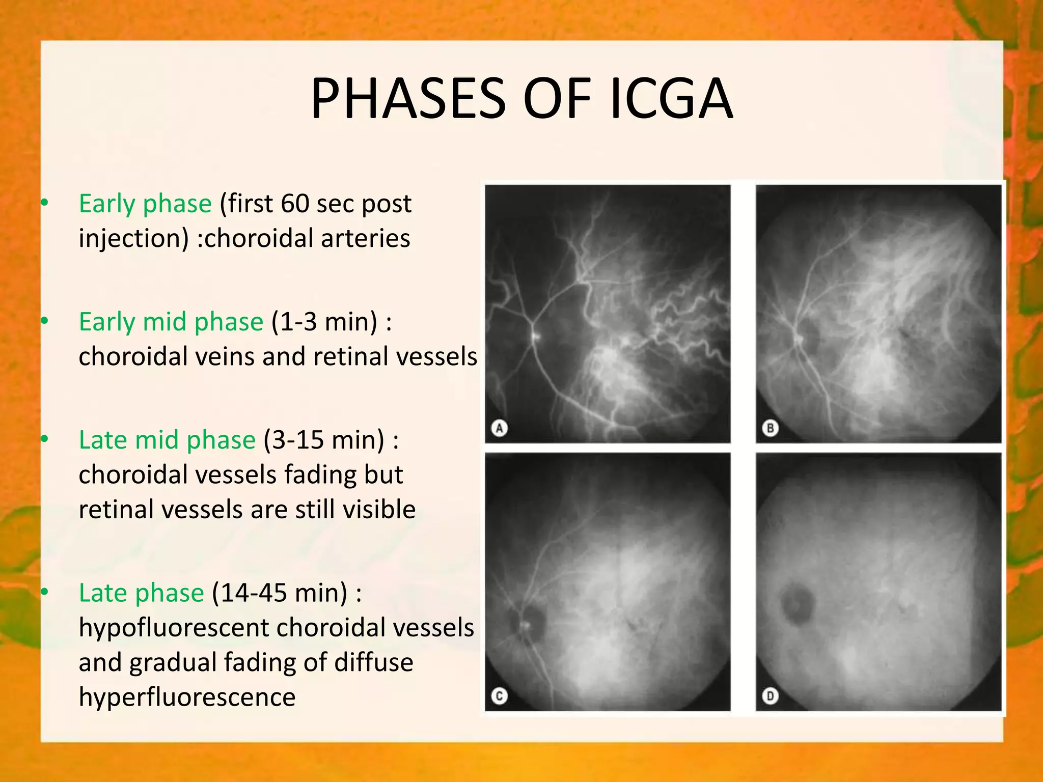 INDOCYANINE GREEN ANGIOGRAPHY | PPTX