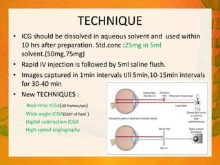 INDOCYANINE GREEN ANGIOGRAPHY | PPTX