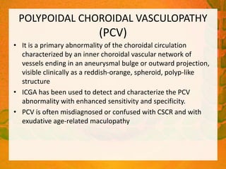 INDOCYANINE GREEN ANGIOGRAPHY | PPTX