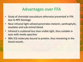 INDOCYANINE GREEN ANGIOGRAPHY | PPTX