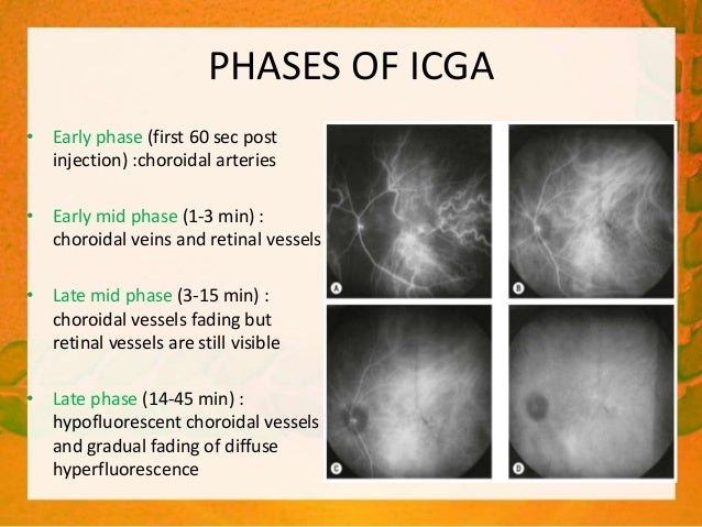 INDOCYANINE GREEN ANGIOGRAPHY