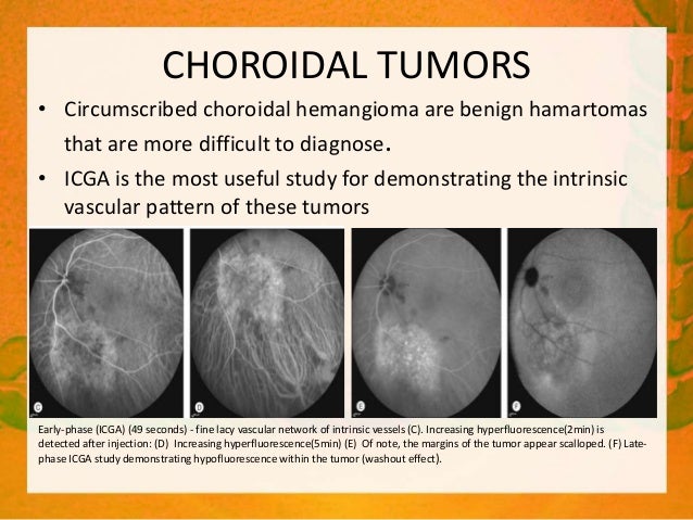 INDOCYANINE GREEN ANGIOGRAPHY