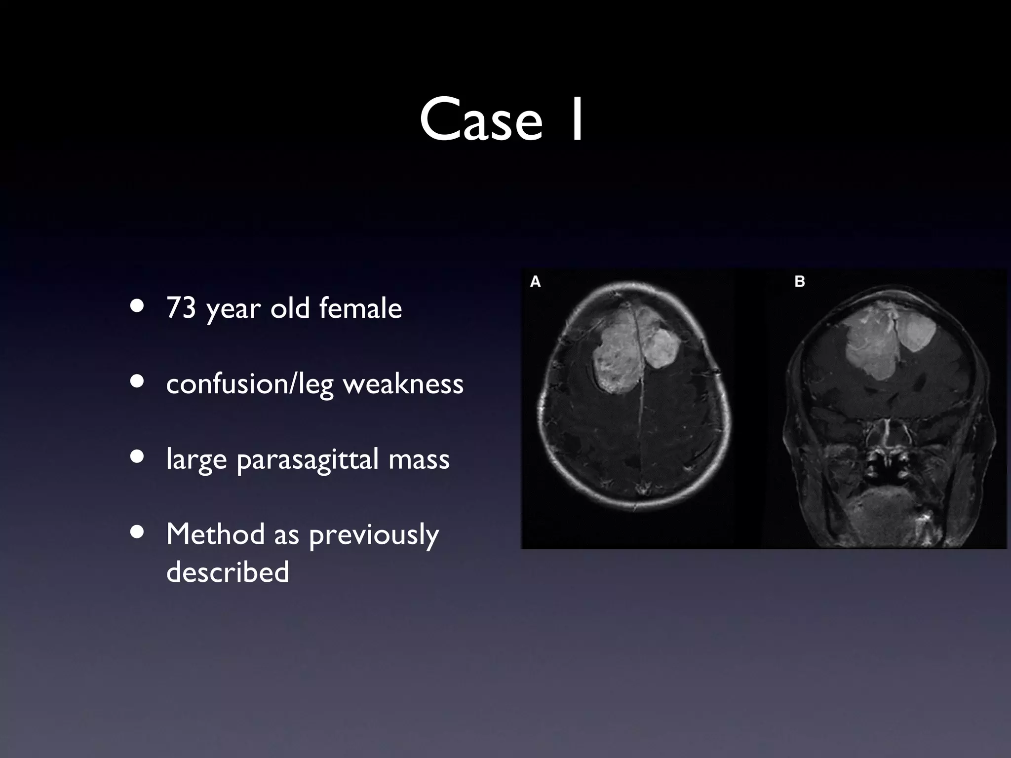Icg and parasagittal lesions akil | PPT
