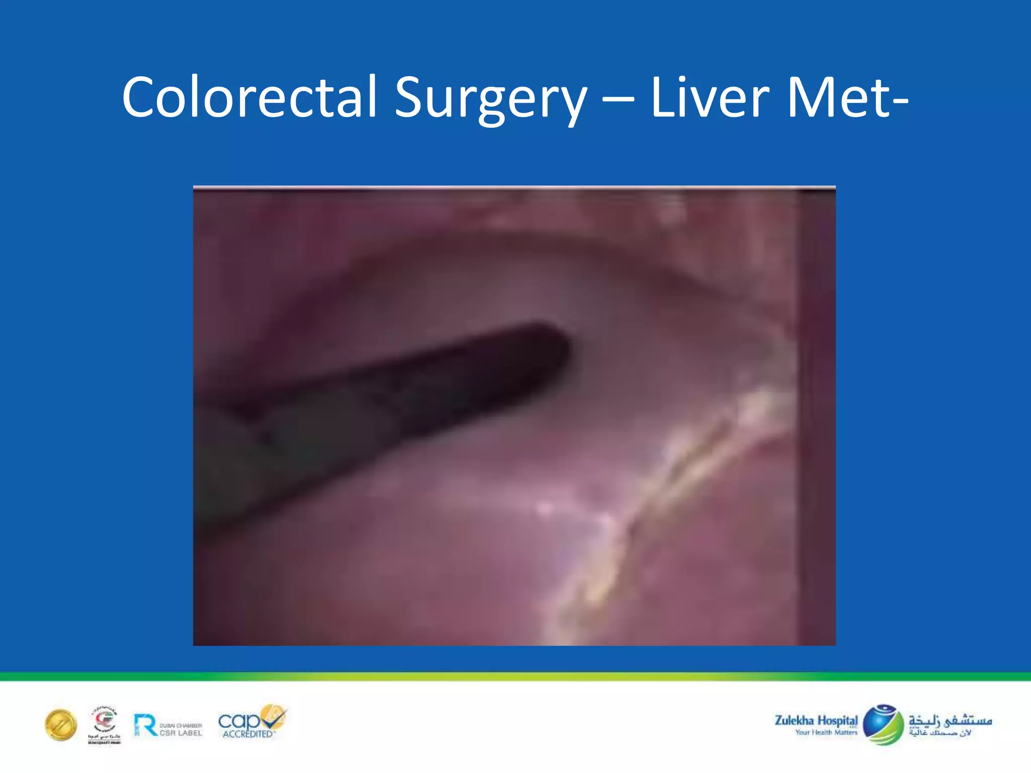 ICG Florence in general and onco surgery | PPTX