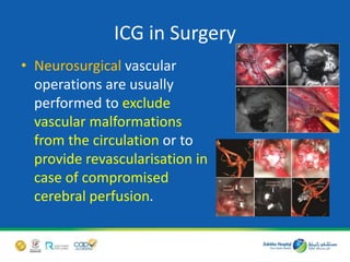 ICG Florence in general and onco surgery | PPTX
