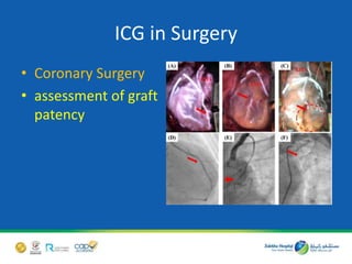 ICG Florence in general and onco surgery | PPTX